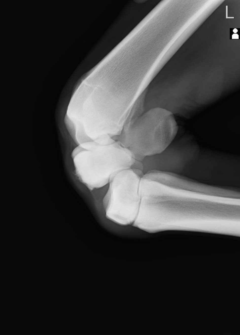 デストゥリエーレ Destriere 牡 4歳 ※中央競馬 登録抹消 | サラブレッドオークション